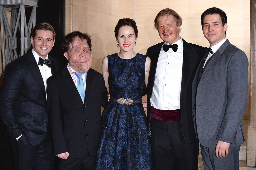 Adam Pearson: 'I wake up every morning, let the universe kick my arse ...